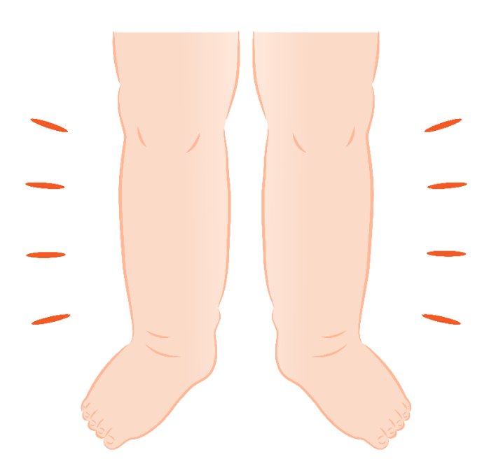 Oedèmes et inflammation - ce que l'homépathie peut vous apporter.